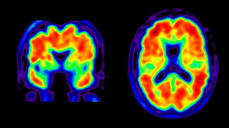 Neurological Diagnostic Tests – Patient Focused Neurology