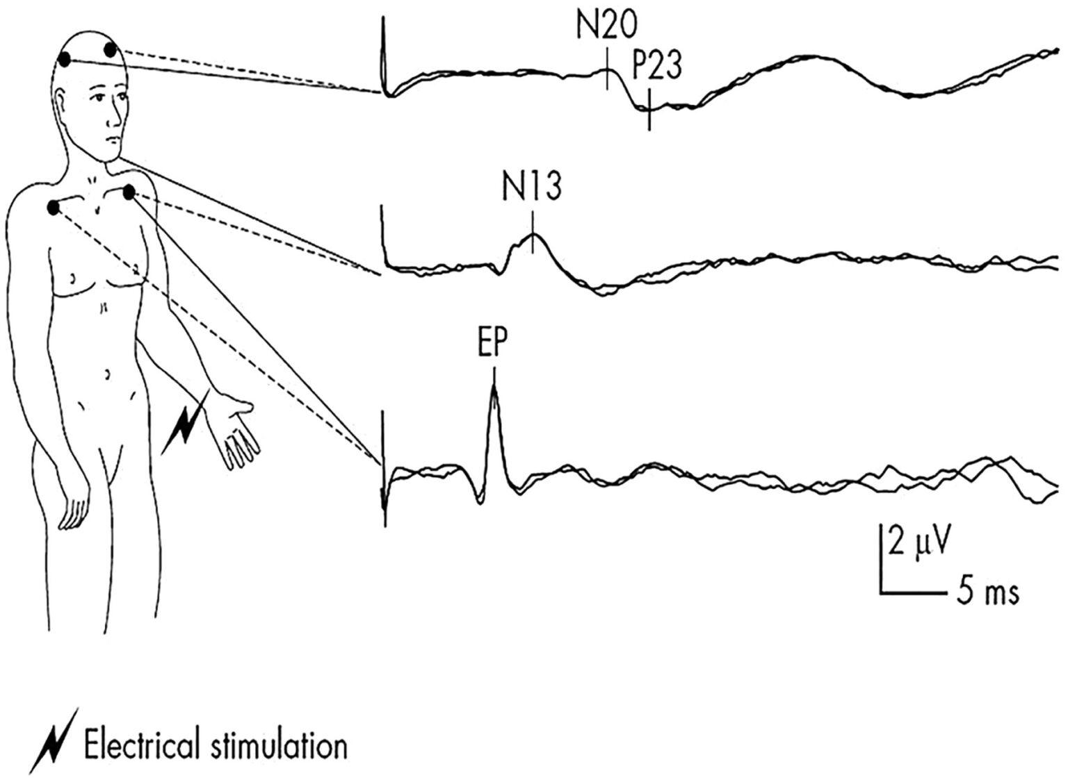 Neurological Diagnostic Tests – Patient Focused Neurology